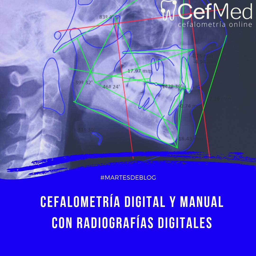 Cefalometría Digital y Manual con Radiografías Digitales Parte II